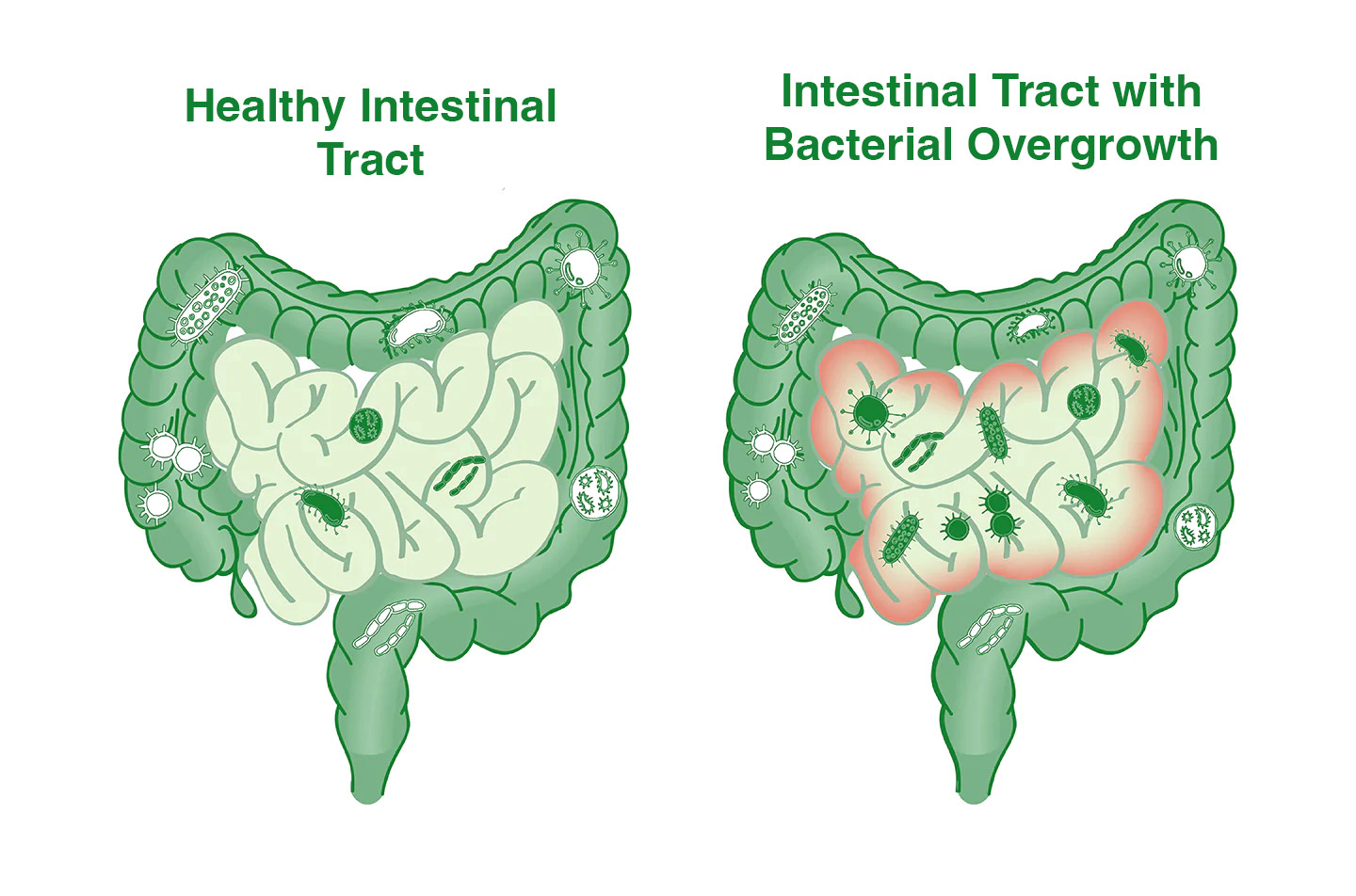 How 3Biome Works | Nutreance