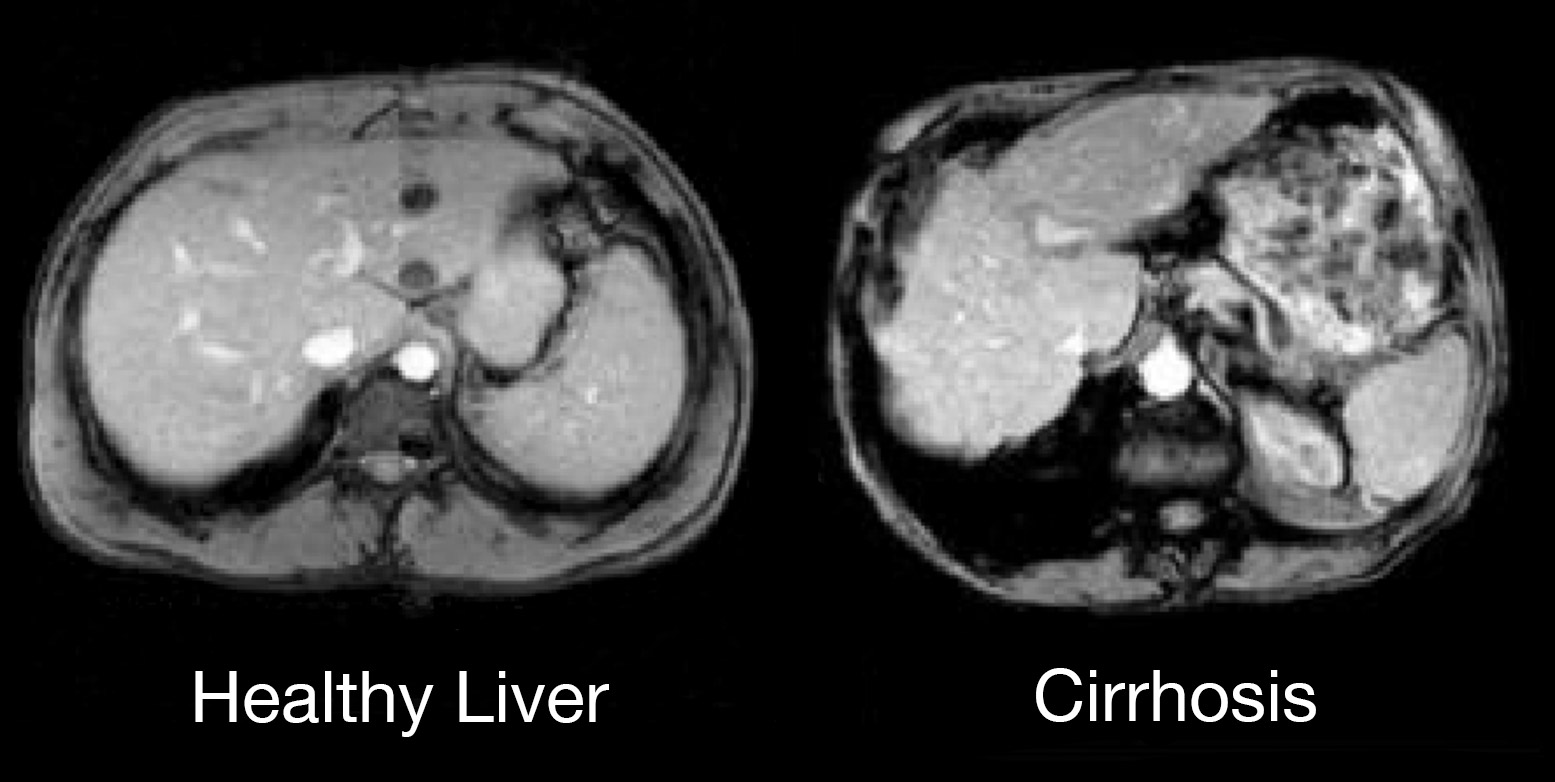 How Hepagard Works | Nutreance