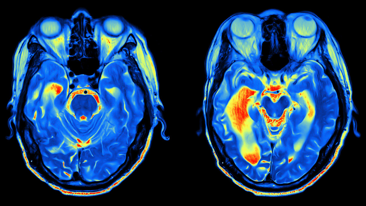 RediCalm: Natural Stress Relief | Nutreance