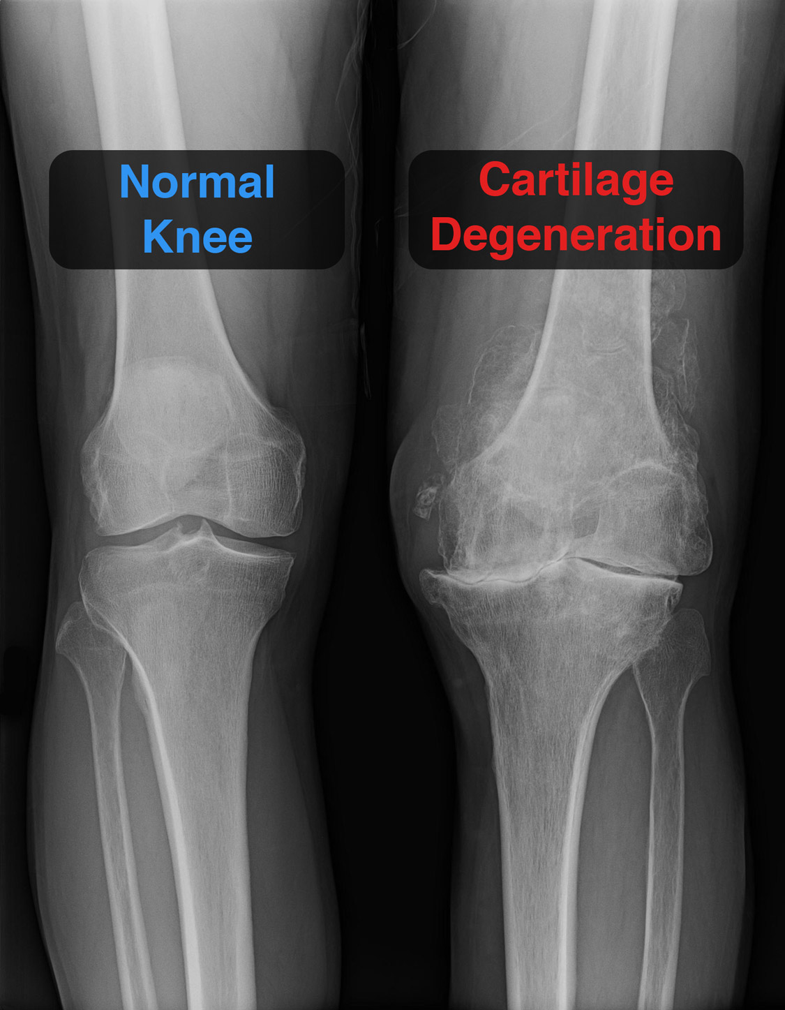 How RediMove Works | Nutreance